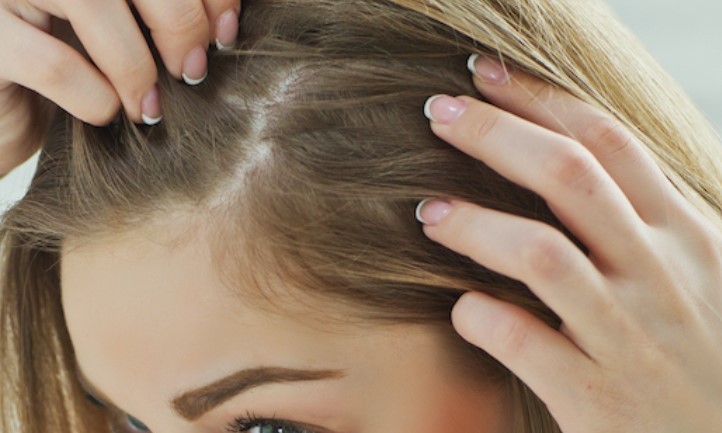 10 bad habits of washing hair will cause you to become bald! - Leh Leo ...