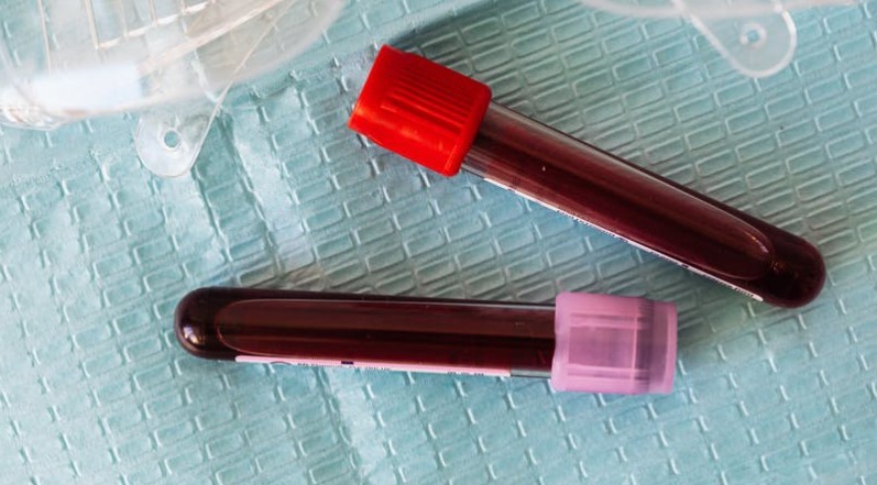 3 signs on face of someone with sticky blood. - Leh Leo Radio News