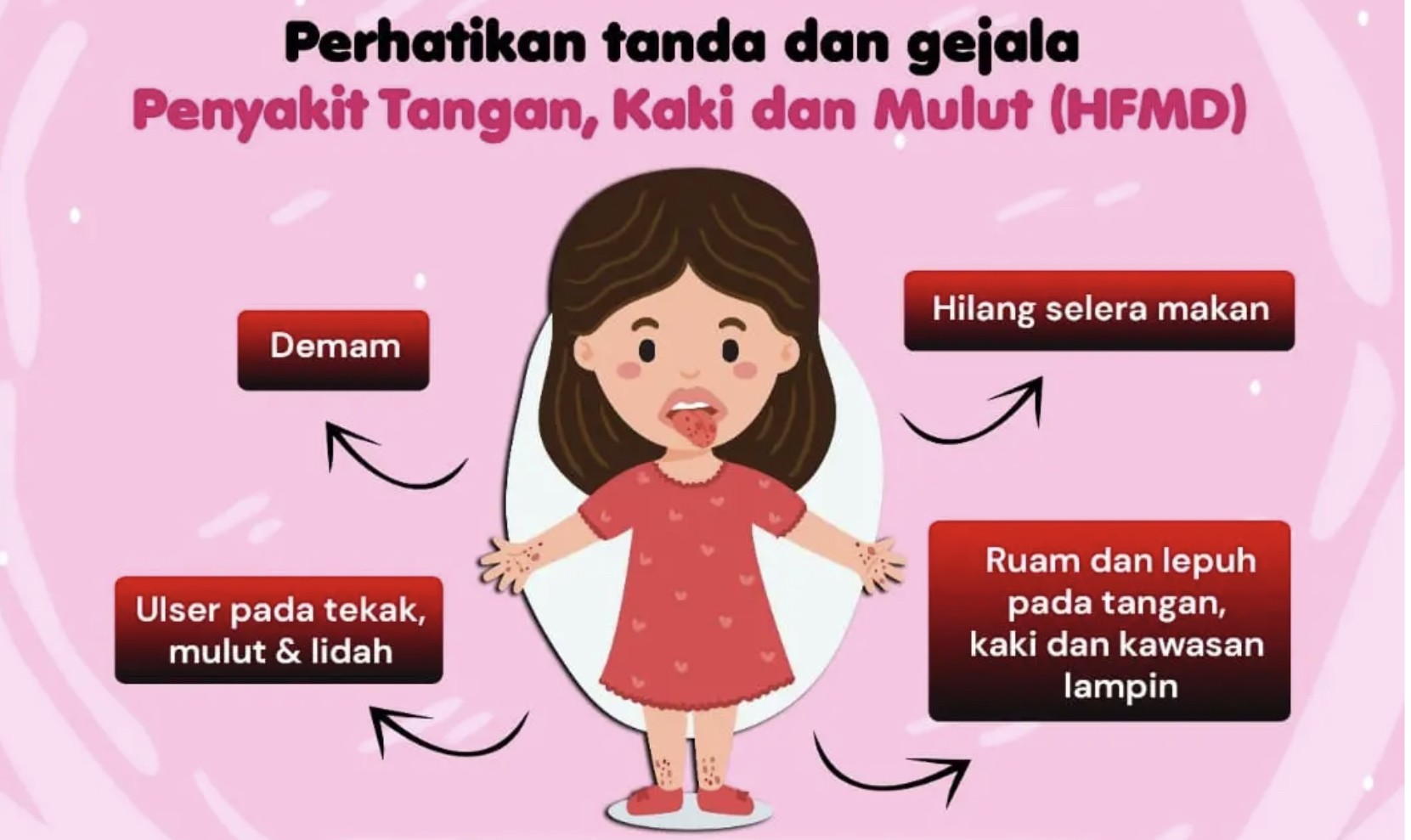 Symptoms of HFMD！ - Leh Leo Radio News